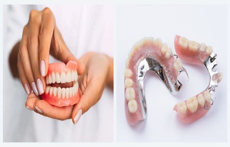 Partial Dentures, Costs, Types, and Side Effects | Kaushikhealthcare.com